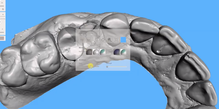 Software MESHMIXER :: 3di dental digital system
